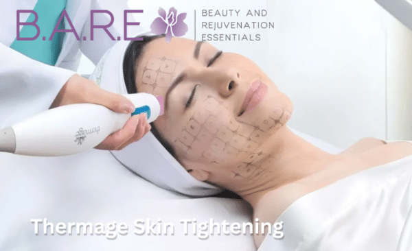 What Is Thermage Skin Tightening? - B.A.R.E. Essentials Spa