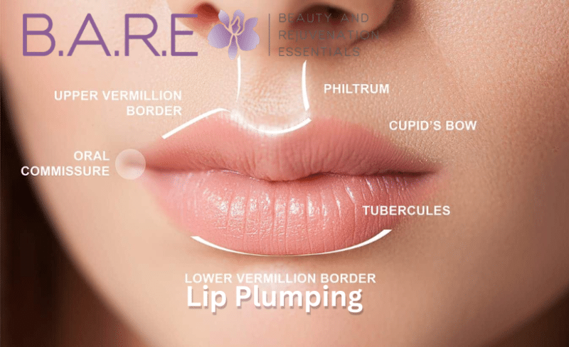Lip Plumping Windsor - B.A.R.E. Essentials Spa