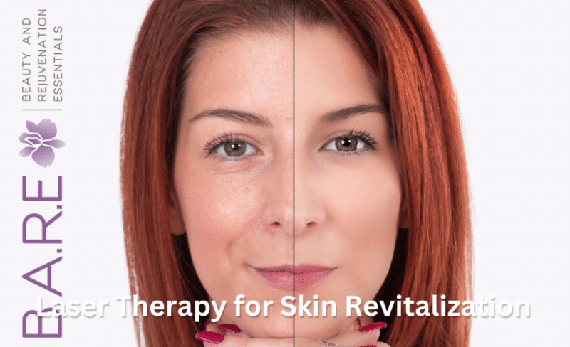 Laser Therapy for Skin Revitalization Tecumseh - B.A.R.E. Essentials Spa